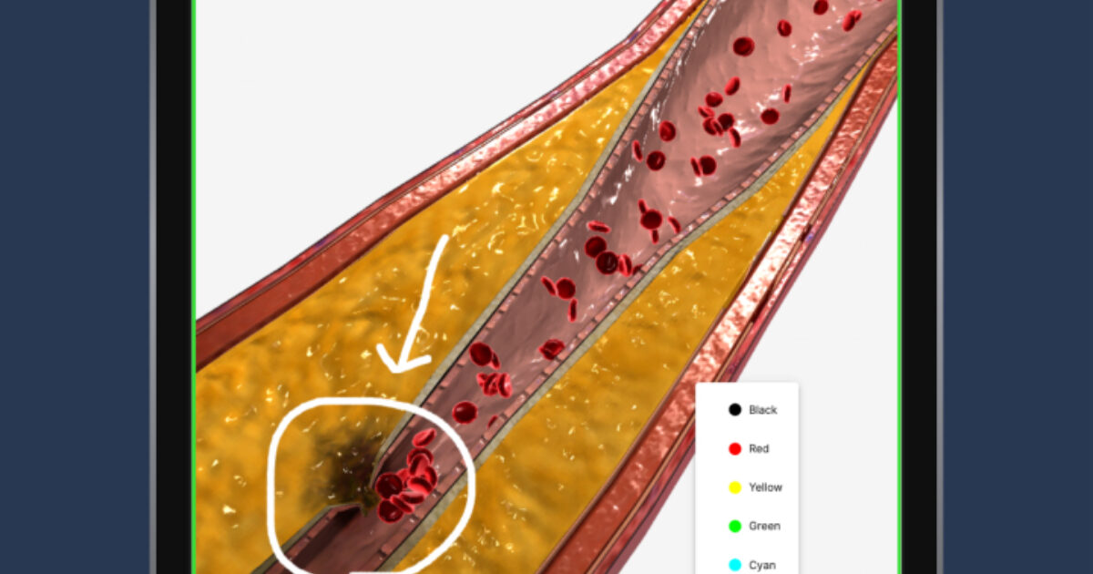 BioDigital | 3D Anatomy Mobile App - BioDigital Human